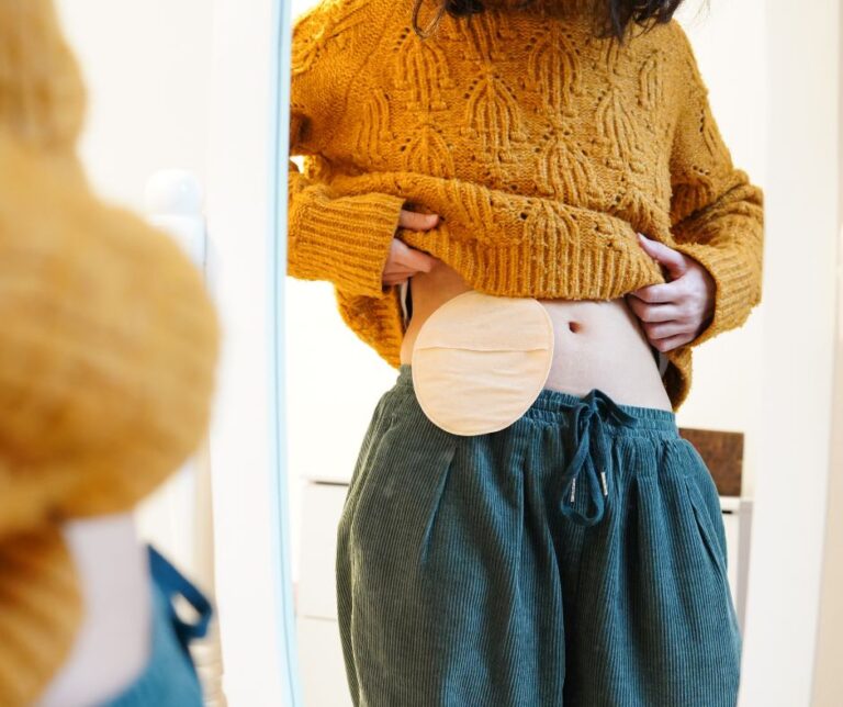 How to Care for and Prevent Ostomy Wounds